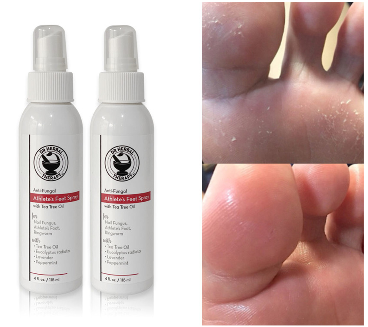 2 PACK Dr. Herbal Therapy Anti-Fungal Athlete's Foot Spray with Tea Tr ...